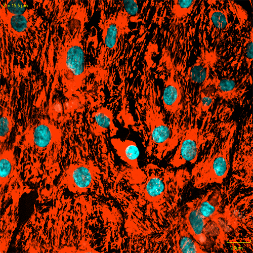 Application – CellArray(セラレイ)