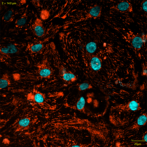 アプリケーション – CellArray(セラレイ)