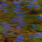 CellArray(セラレイ) – 播くだけで心筋細胞が配向する細部培養基材