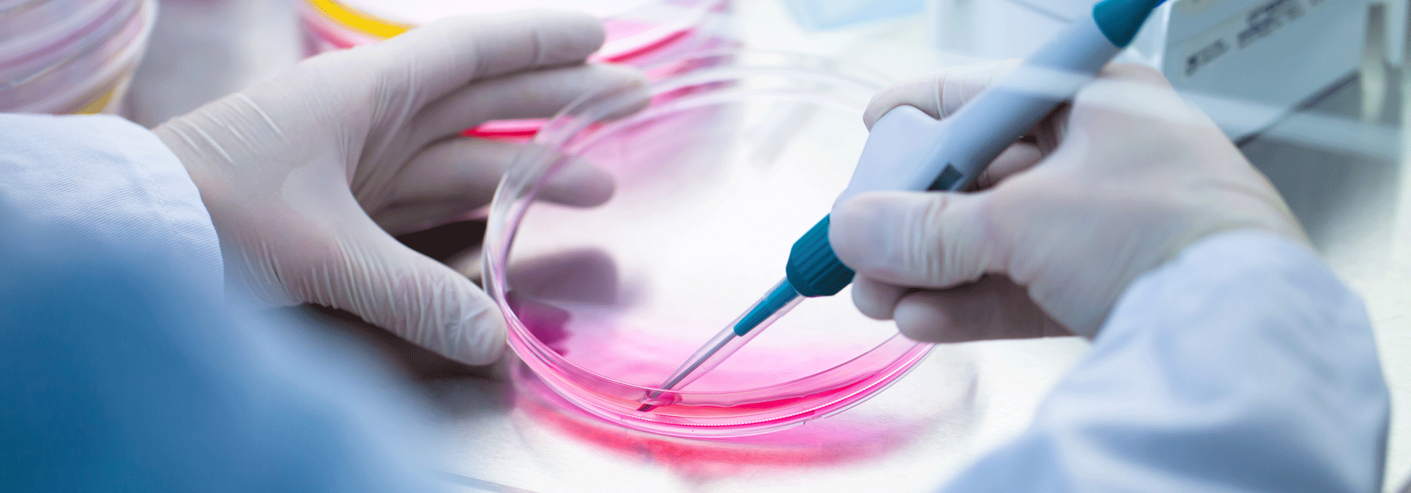 CellArray – 播くだけで心筋細胞が配向 ｜Cell Culture Device